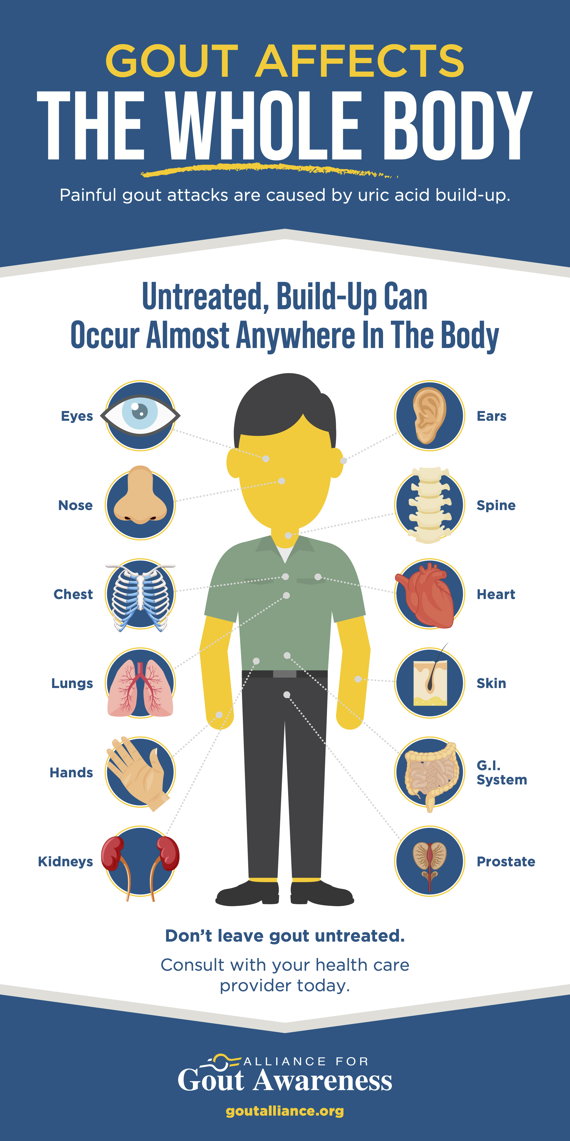 Gout Affects the Whole Body - Alliance for Gout Awareness